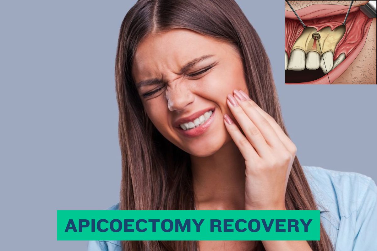 How long does it take to recover from an Apicoectomy?