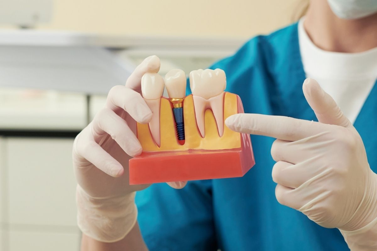 What Is the Step-by-Step Process of Getting a Dental Implant?