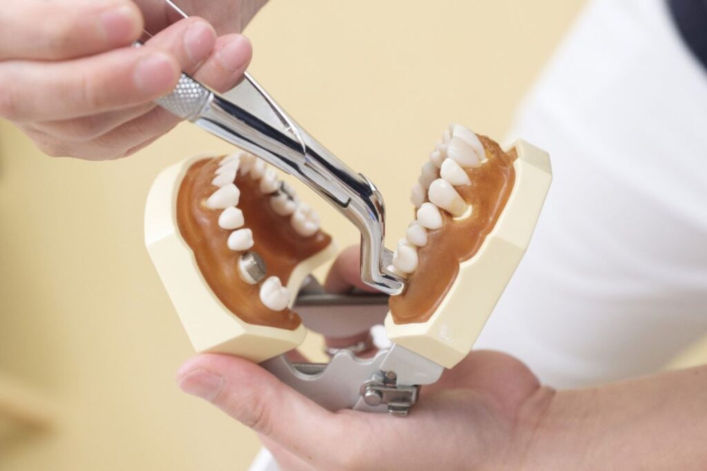 Do Molars Grow Back After Tooth Extraction?